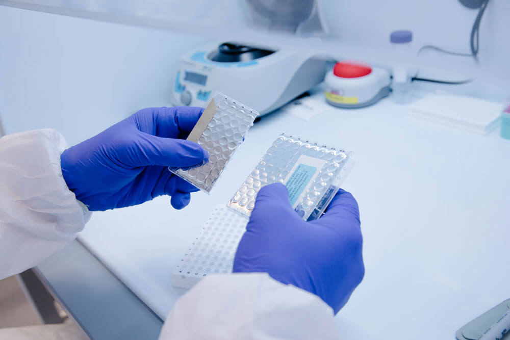 Multiplex Gastrointestinal Pathogen Simplicity Panel™